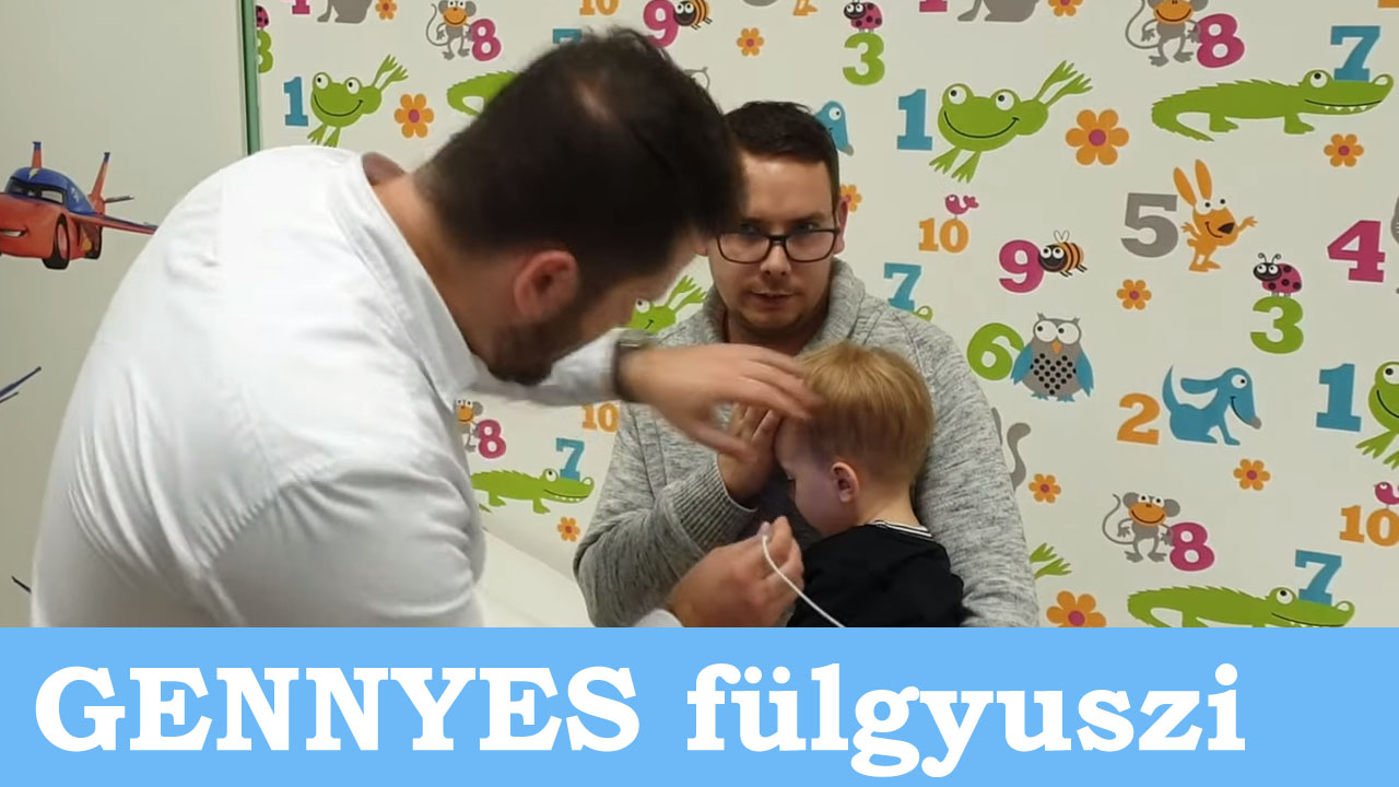 Így gyógyul a gennyes középfülgyulladás - antibiotikum nélkül - dr ...